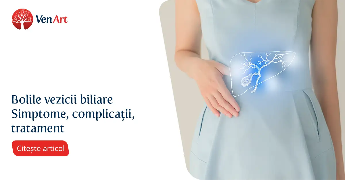 Bolile vezicii biliare - Simptome, complicații, tratament.