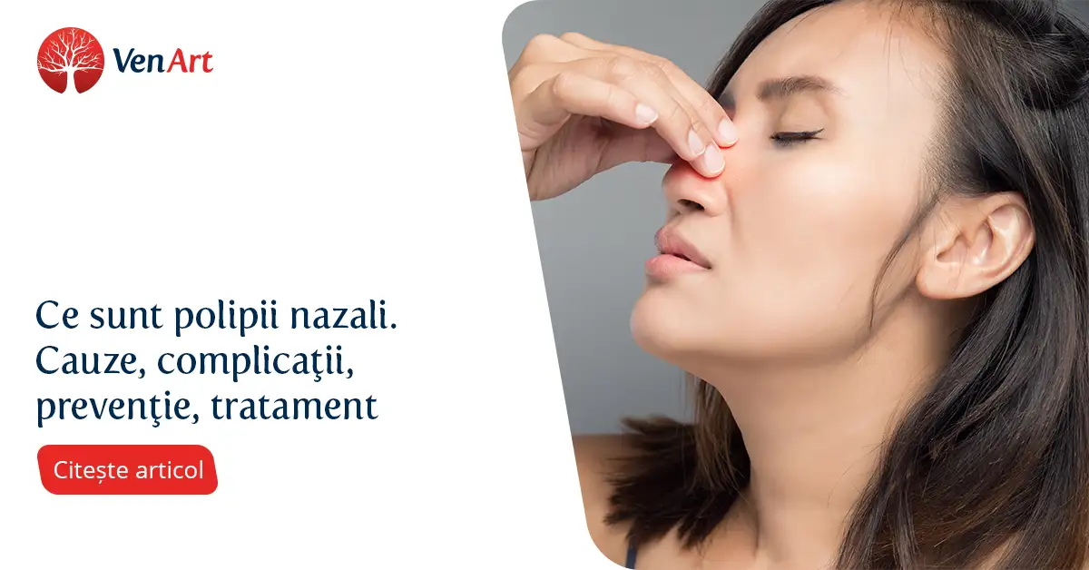 Polipii nazali - cauze, complicaţii, prevenţie, tratament