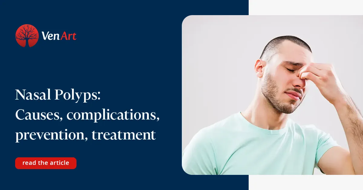 Nasal Polyps: Causes, Complications, Prevention, Treatment
