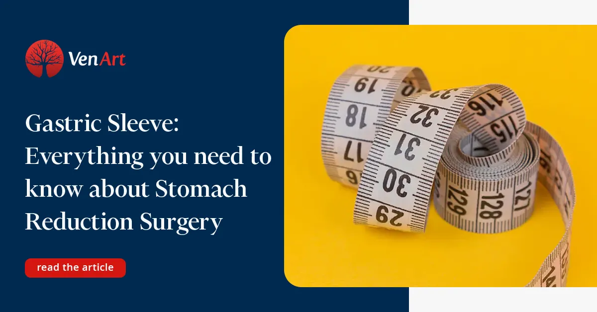 Gastric Sleeve Surgery | VenArt Clinic