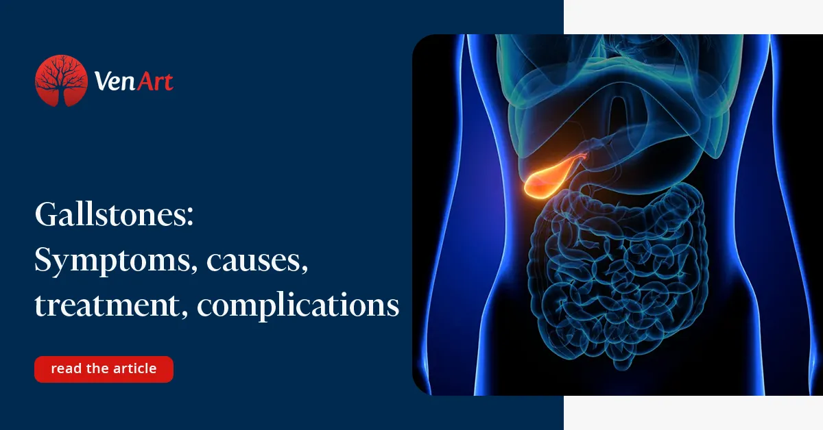 Gallstones: Symptoms, Causes, Treatment | VenArt Clinic