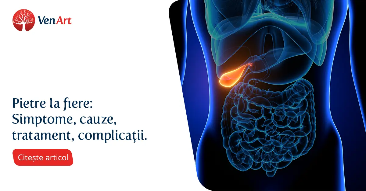 Pietre la fiere: simptome si tratamentul pietrelor | Clinica VenArt