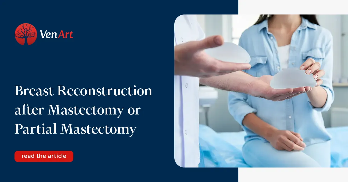 Breast Reconstruction After Mastectomy | VenArt Clinic