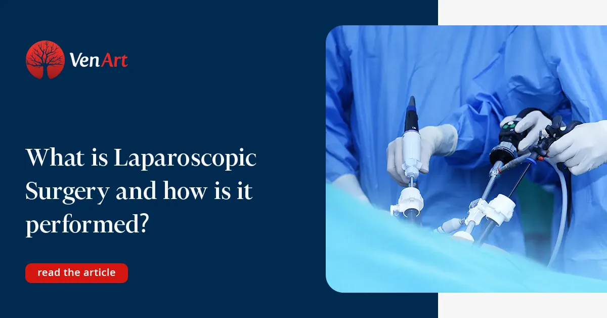 Laparoscopic Surgery | VenArt Clinic