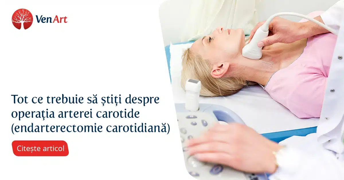 Tot ce trebuie să știți despre operația de carotida infundata