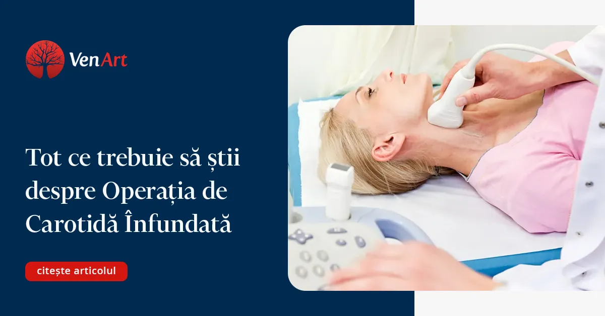 Tot ce trebuie să știți despre operația de carotida infundata