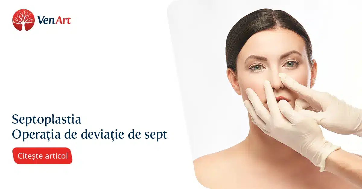 Când este necesară o septoplastie (operație de deviație de sept)?