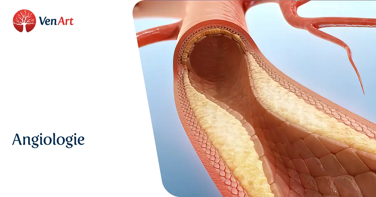 Angiologie - Diagnosticul bolilor Vasculare -Clinica VenArt