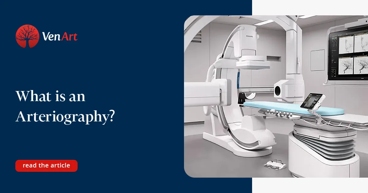 What Is an Arteriography? | VenArt Clinic