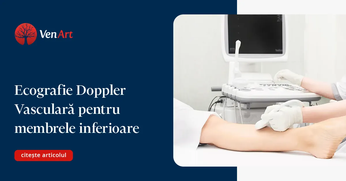Ecografie Doppler Vasculară pentru membrele inferioare
