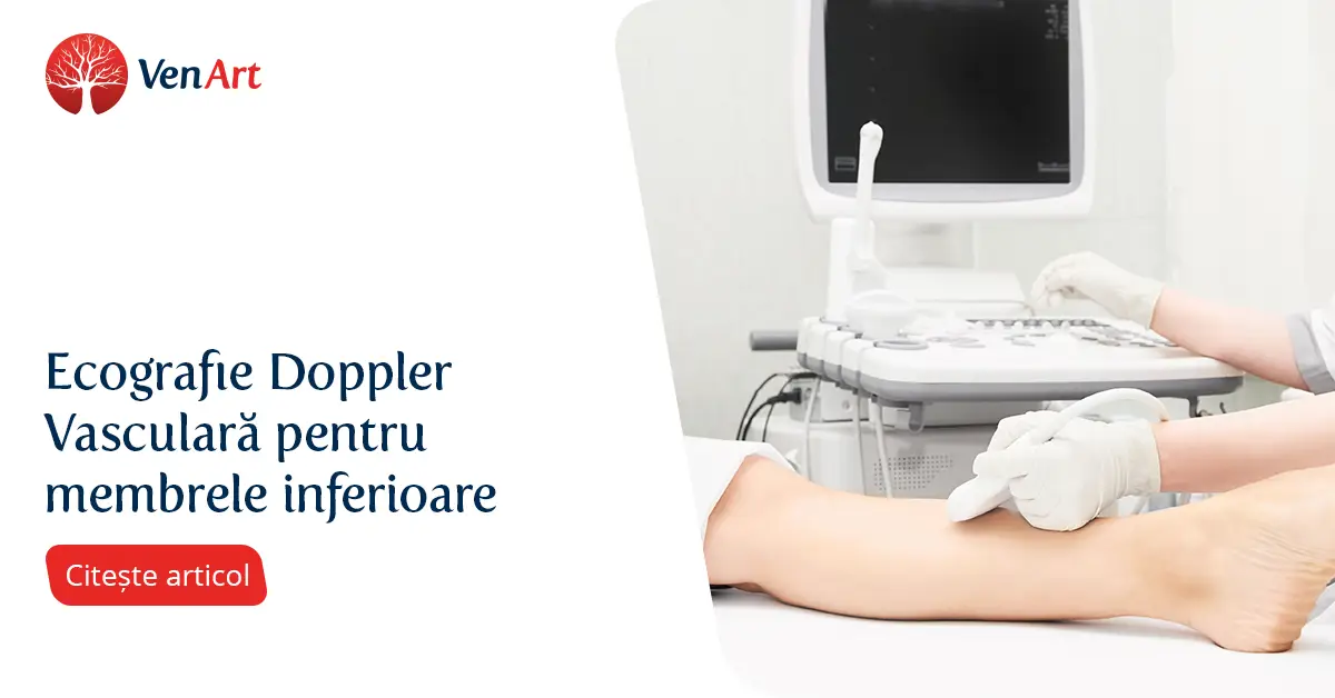 Ecografie Doppler Vasculară pentru membrele inferioare | VenArt