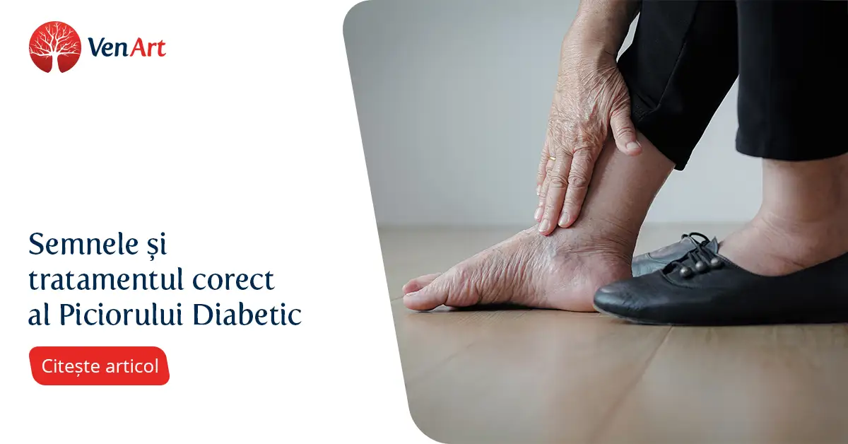 Piciorul Diabetic: Prevenție, Simptome și Tratamente Inovative