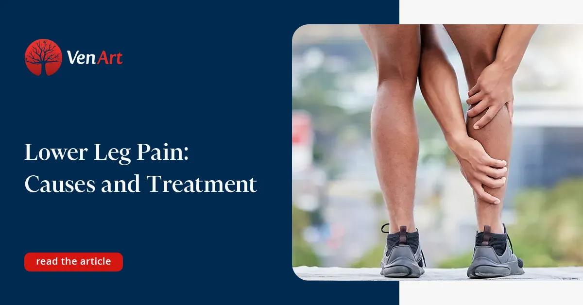 Lower Leg Pain – Causes and Treatments | VenArt Clinic