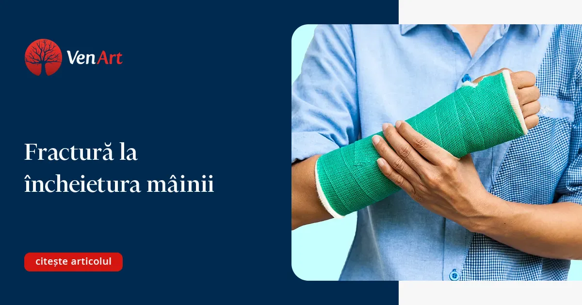 Fractura la incheietura mainii - tratamente | Clinica VenArt