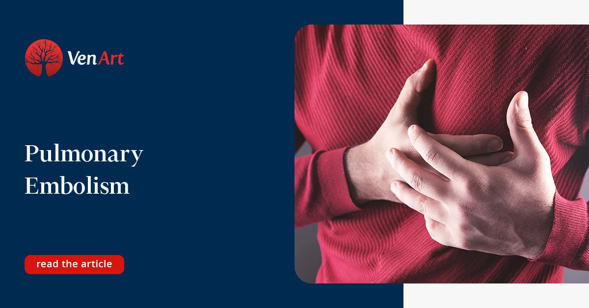Pulmonary embolism | VenArt Clinic