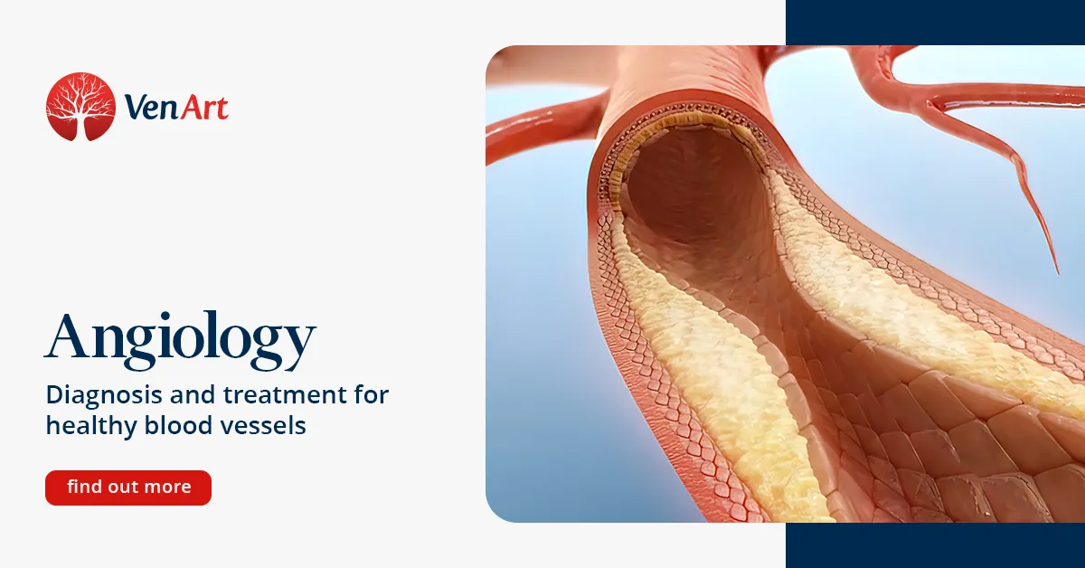 Angiology | VenArt Clinic