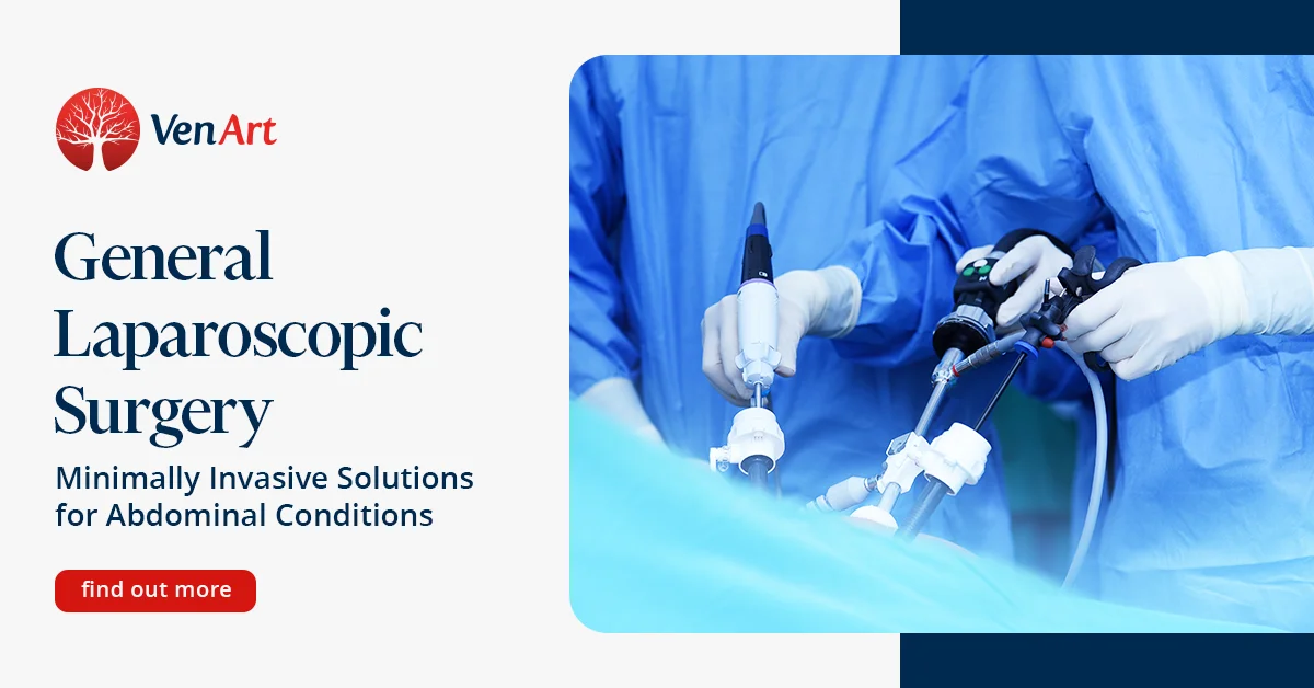 General Laparoscopic Surgery