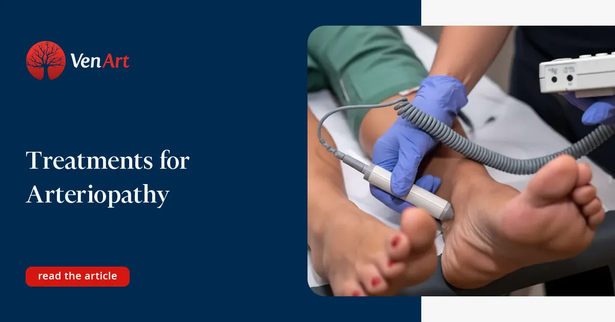 Treatments in arteriopathy | VenArt Clinic