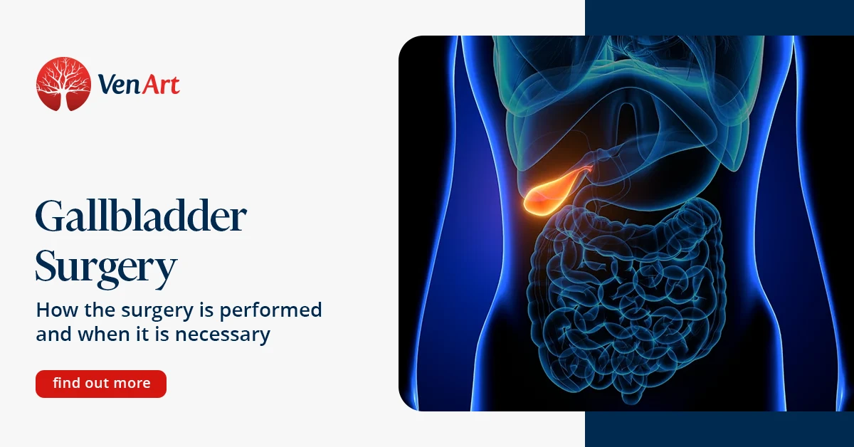 Gallbladder Surgery | VenArt Clinic