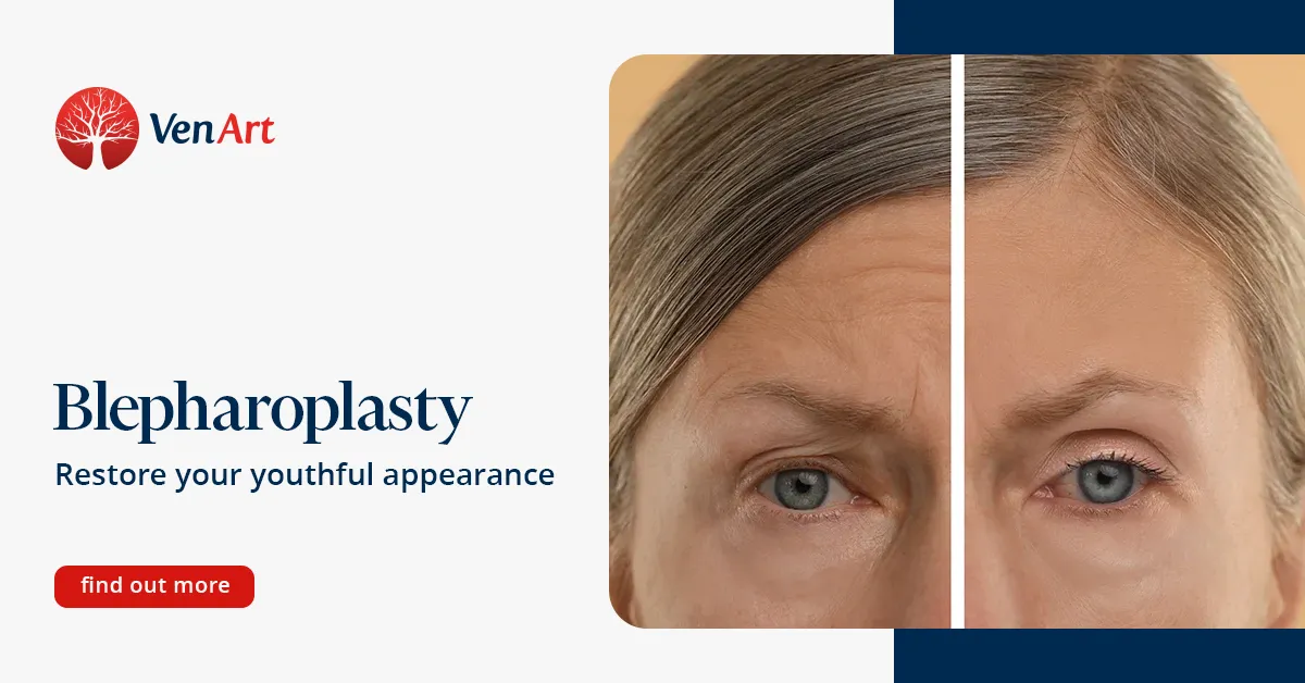 Blepharoplasty | VenArt Clinic