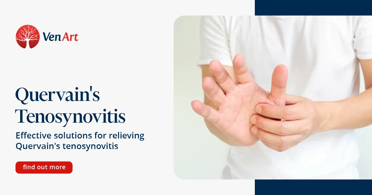 Quervain's tenosynovitis | VenArt Clinic