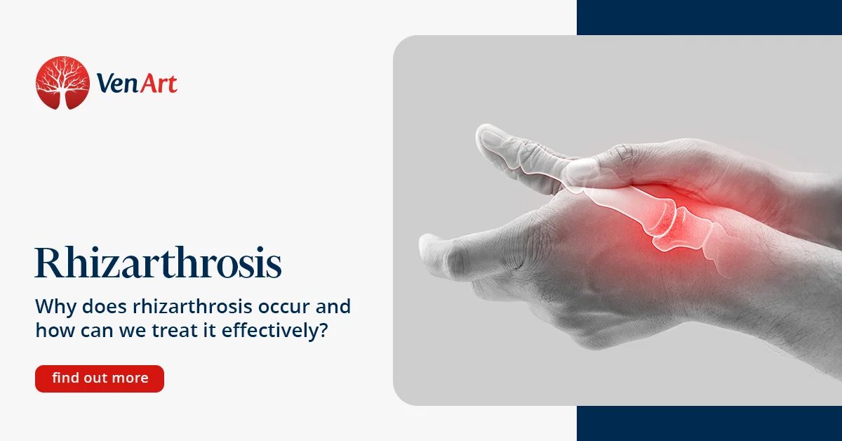 Rhizarthrosis | VenArt Clinic
