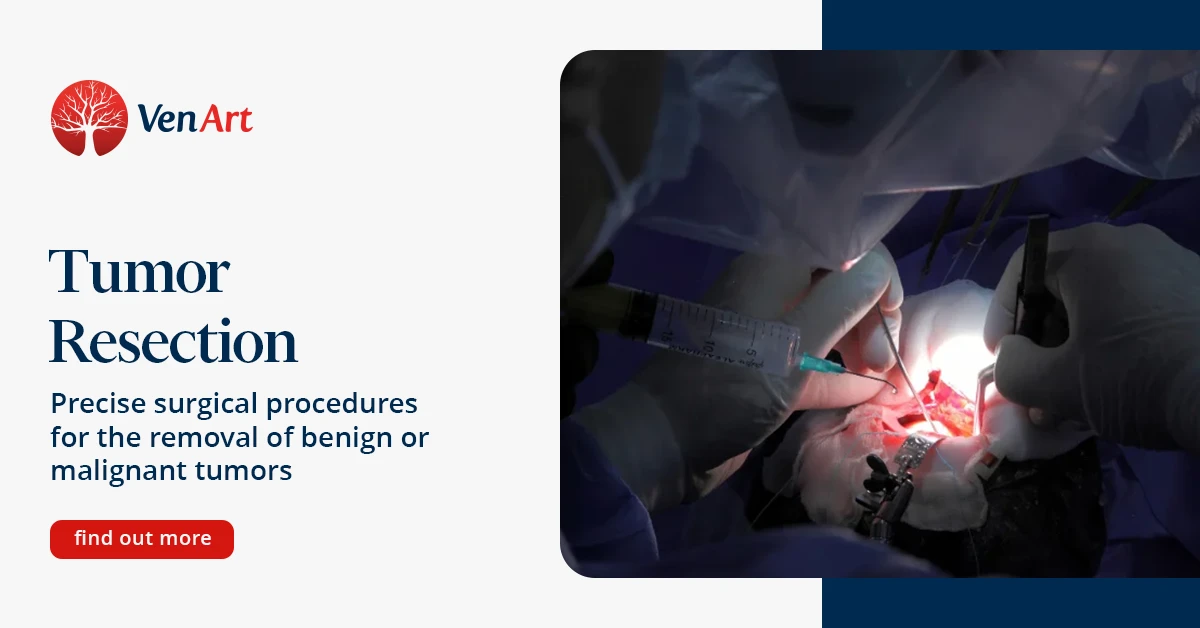 Tumor Resection | VenArt Clinic