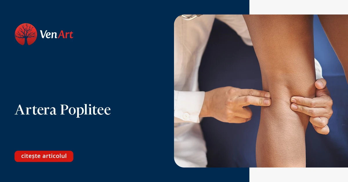 Artera poplitee | Complicații și Tratament Moderne | Clinica VenArt