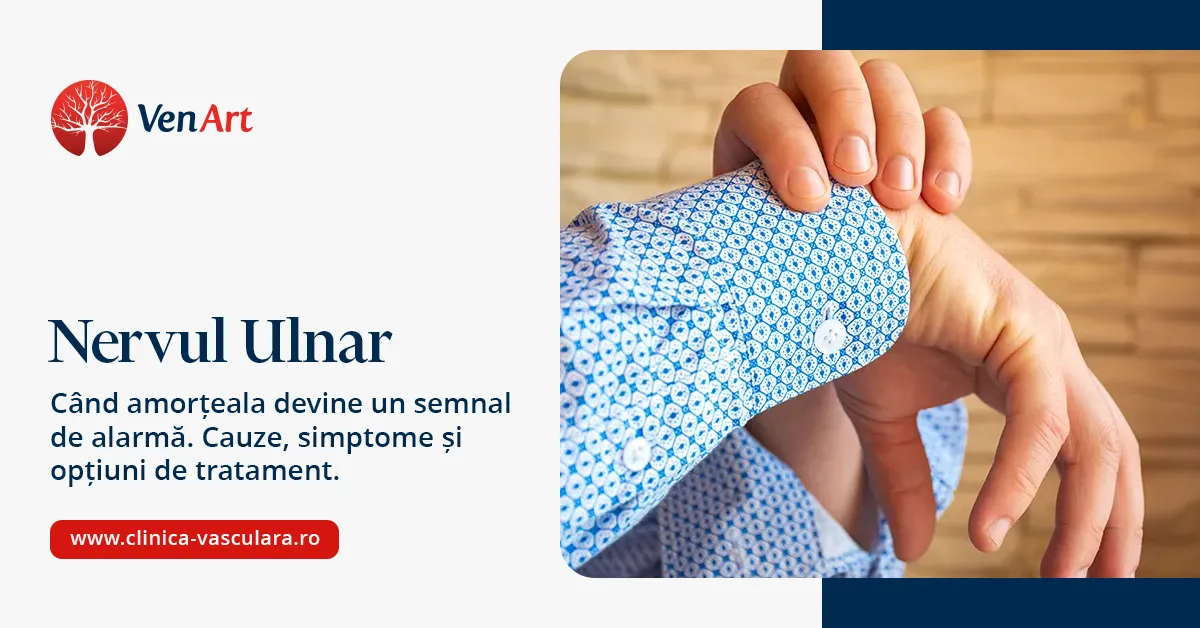 Nervul Ulnar | Clinica VenArt