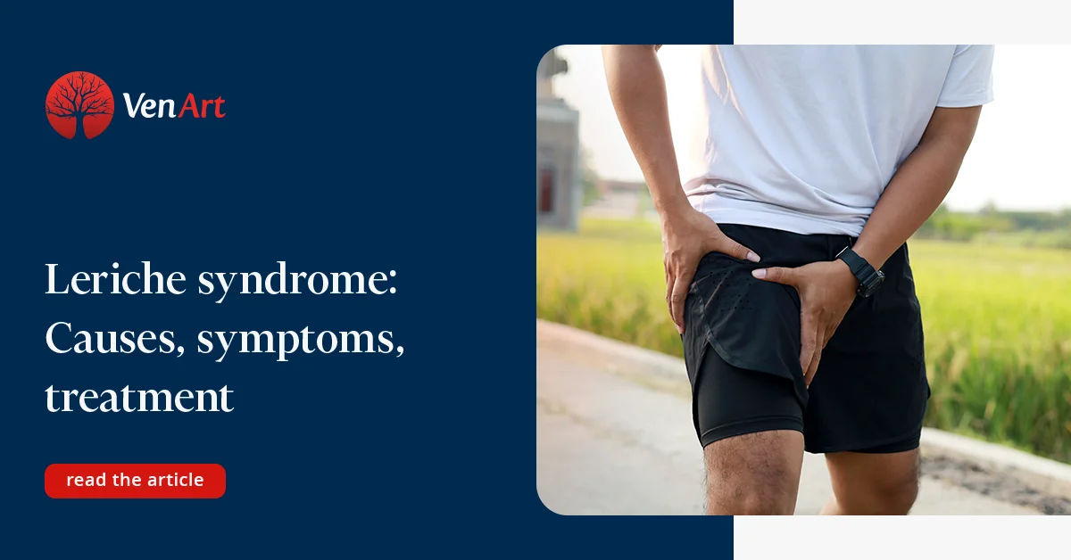 Leriche syndrome: Causes, symptoms, treatment | VenArt Clinic